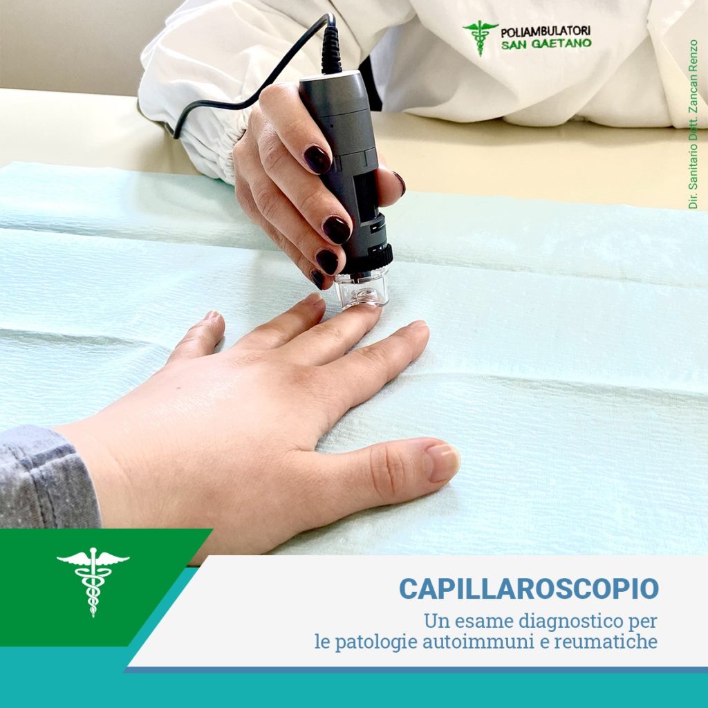 Che cos'è la capillaroscopia? - AltoVicentinOnline
