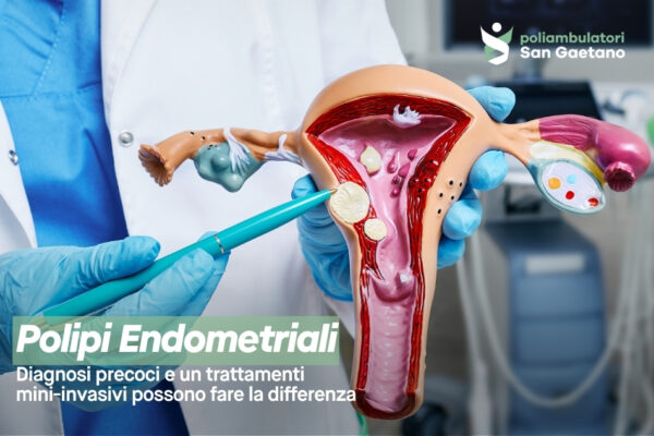 Polipi endometriali: diagnosi e rimozione in day hospital, senza dolore ...