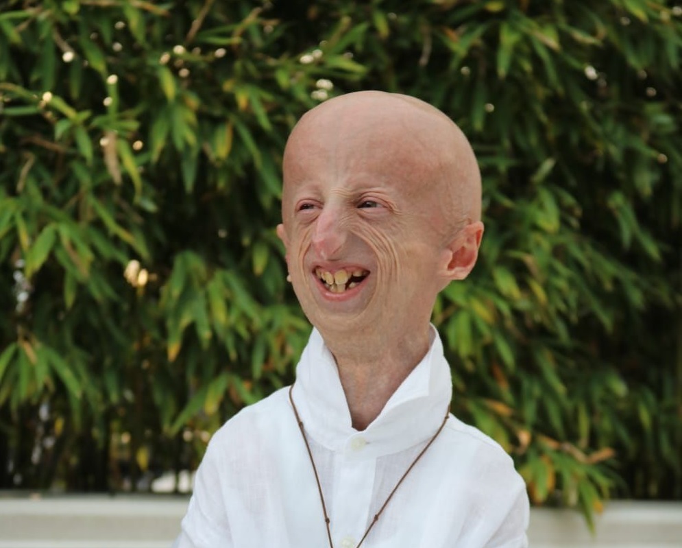 Il testo della lettera che ci ha lasciato Sammy Basso prima di morire ...